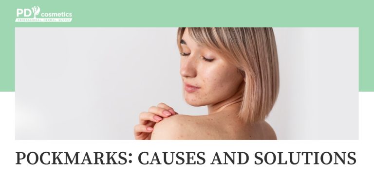 Pockmarks: Causes and Solutions - PDCosmetics