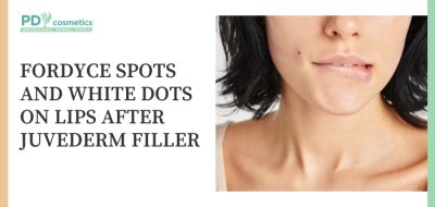 Restylane Filler Comparison Chart: Types and Uses Explained - PDCosmetics