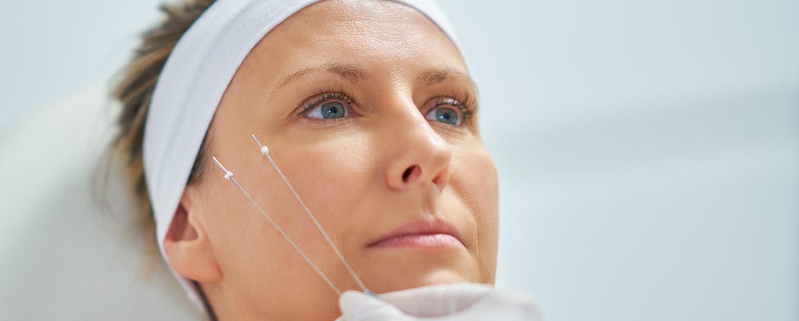 How Long Do PDO Threads Last? - PDCosmetics